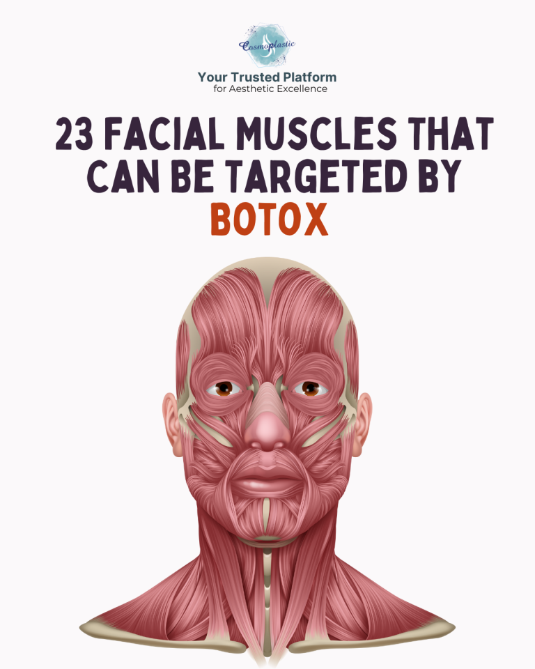 23 Facial Muscles That Can Be Targeted by Botox - Cosmoplastic